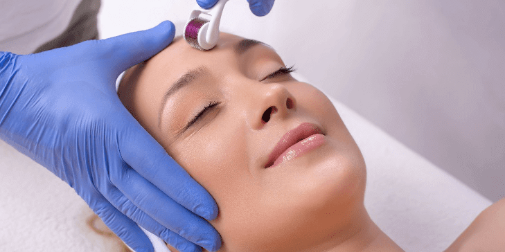 How Does Collagen Induction Therapy Work? | Glow Laser Beauty